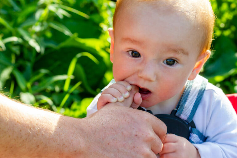 Are Babies Born with Freckles? Top 6 Frequently Asked Questions